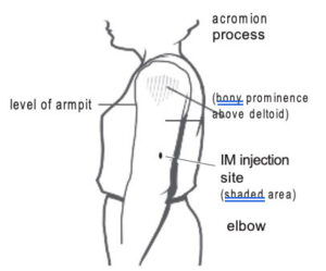 Vaccine Administration | Clinician’s Handbook for Childhood & Adult ...