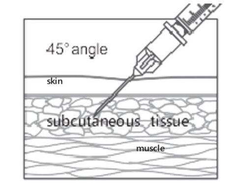 Vaccine Administration | Clinician’s Handbook for Childhood & Adult ...
